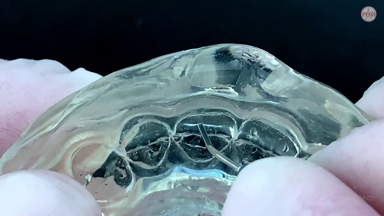 Injection molding technique with new GC G ænial Universal Injectable ...