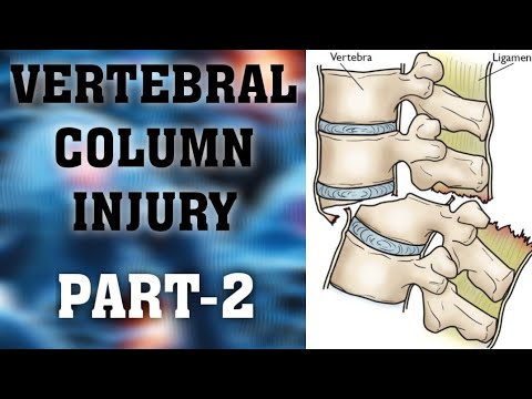 VERTEBRAL COLUMN INJURY || PART-2 || MECHANISM OF INJURY || STABLE ...
