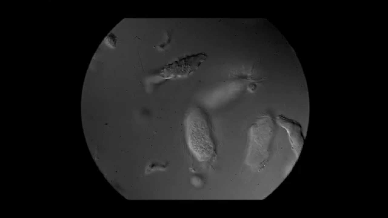 Termite gut microscopy - YouTube