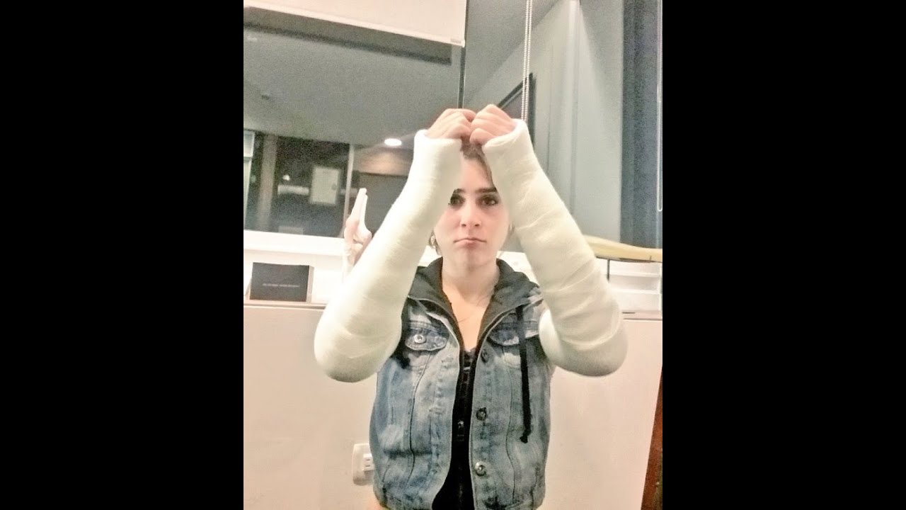 Story of model and actress who fractures both arms training ...