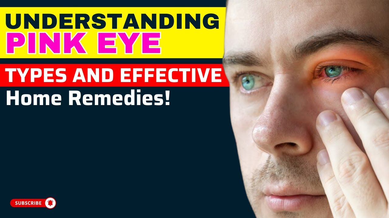 How to TREAT PINK EYE Types and Effective Home Remedies! - YouTube