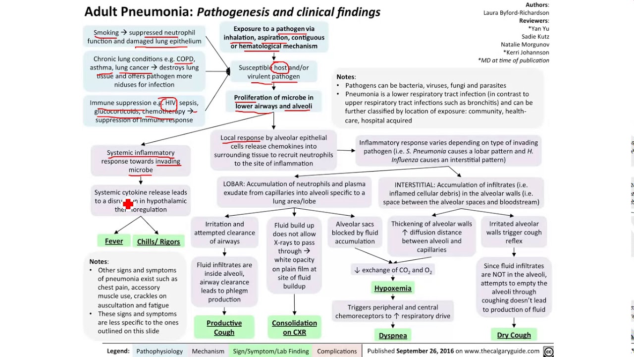 Patogenesis dan Klinis Pneumonia pada orang DEWASA | Respirasi | Paru ...