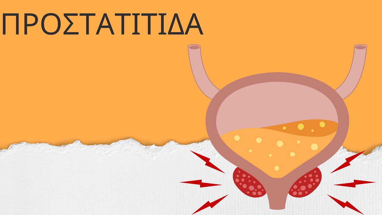 Αυτοθεραπεύσου από την προστατίτιδα!! - YouTube