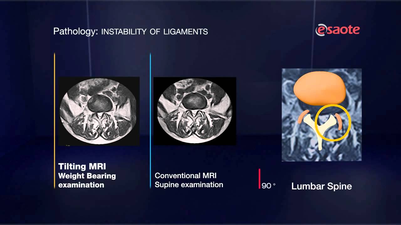 ESAOTE Tilting MRI - Add weight to your diagnosis with G-scan! - YouTube