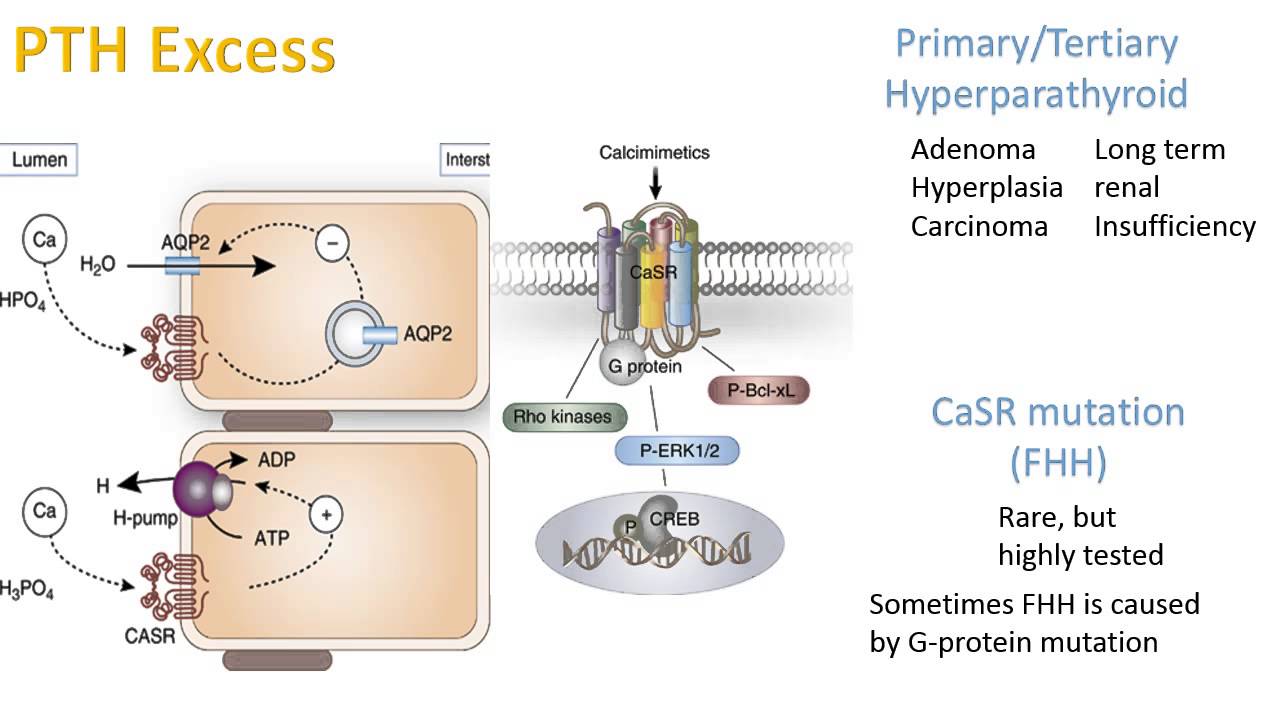 Hypercalcemia and Hypocalcemia - YouTube