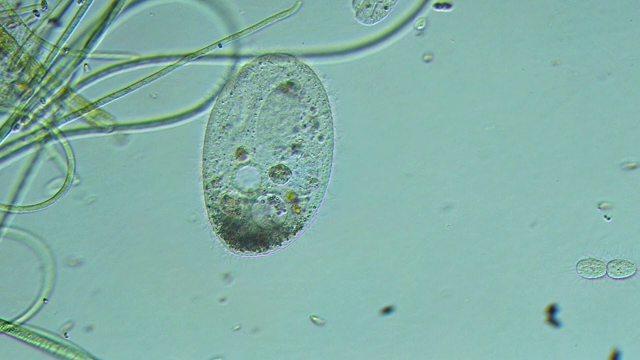 Ciliate: Frontonia acuminata - YouTube