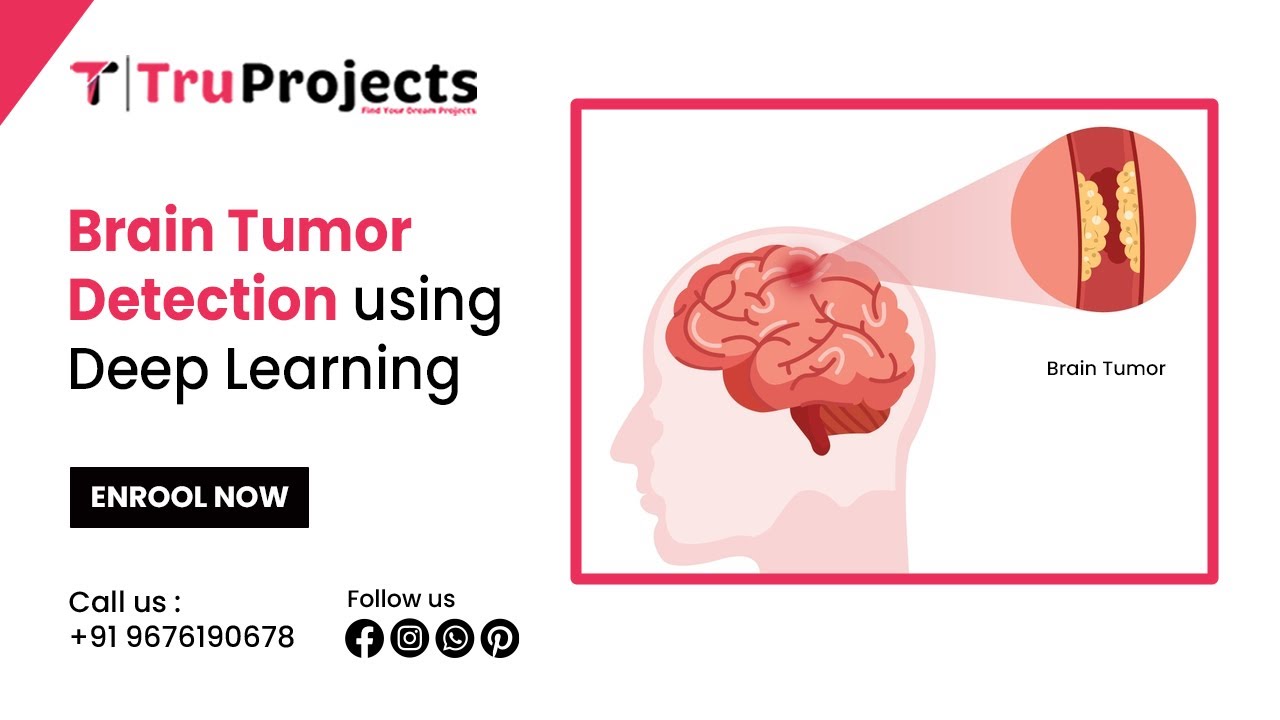 Brain Tumor Detection using Deep Learning latest trending btech mini ...