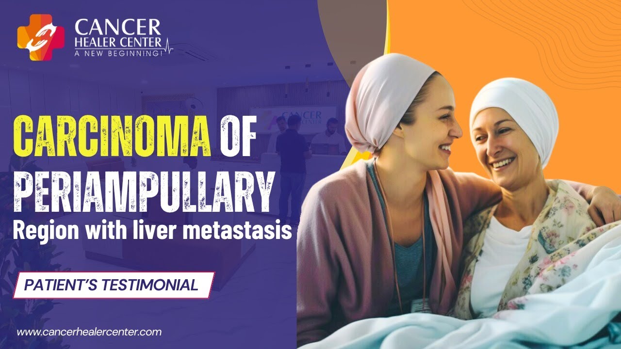 Carcinoma Of Periampullary Region With Liver Metastasis | Cancer Healer ...