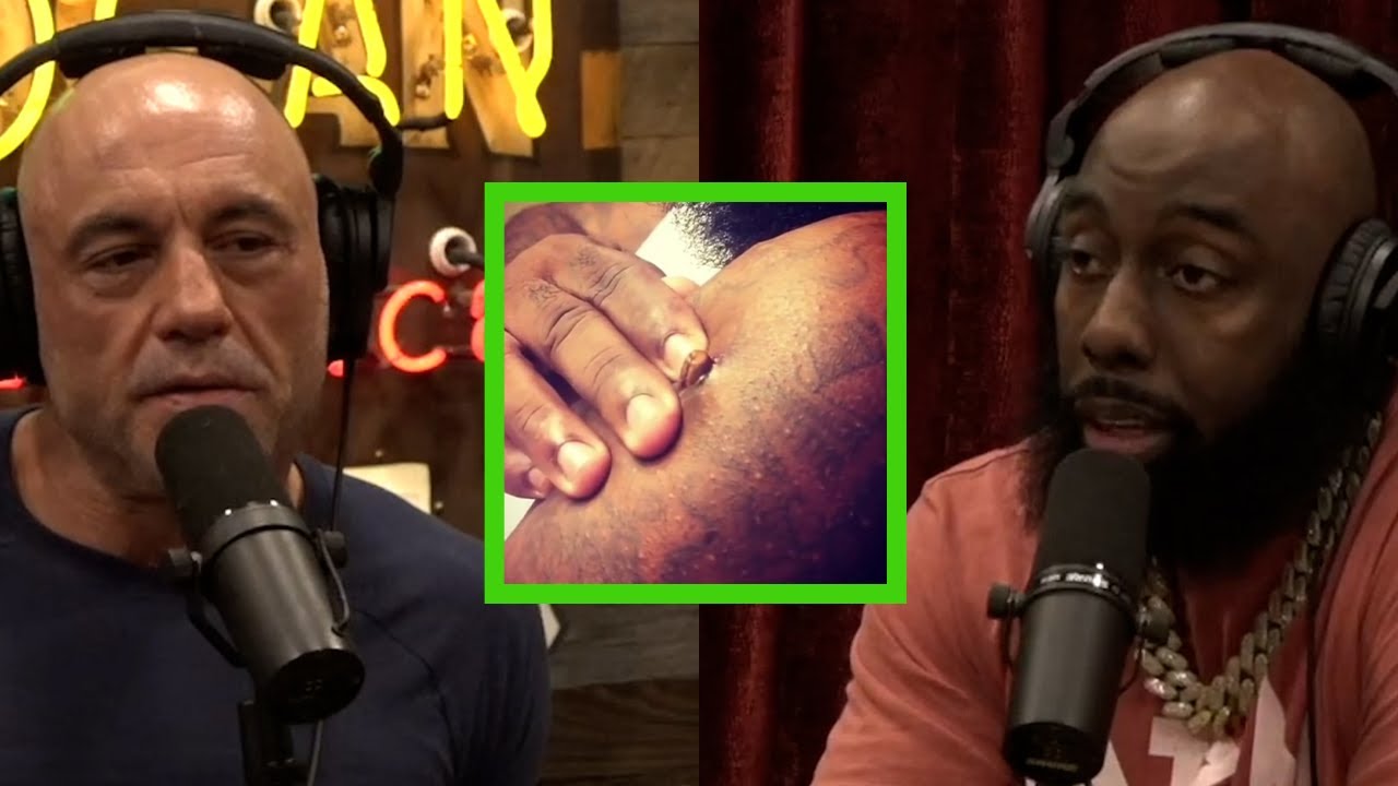 Trae the Truth on Getting Shot and Having the Bullet Stuck in His Arm ...