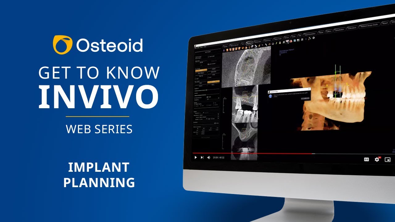 Webinar: Get to Know Invivo - Implant Planning - YouTube