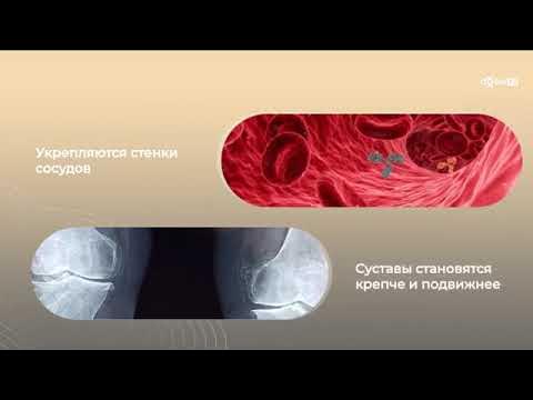 3Д Матрикс - Здоровье суставов и сосудов, активная выработка коллагена ...