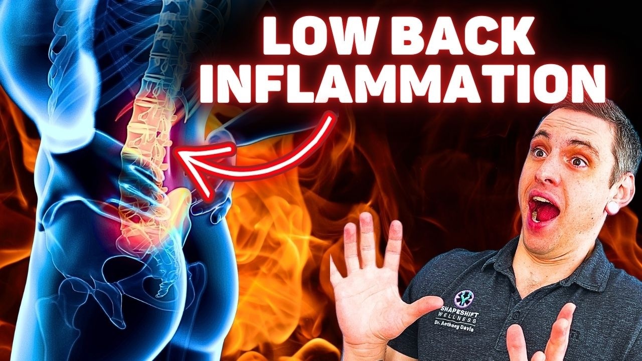 The Real ROOT CAUSE of Chronic Back Pain (pt.4) - Low Back Inflammation ...