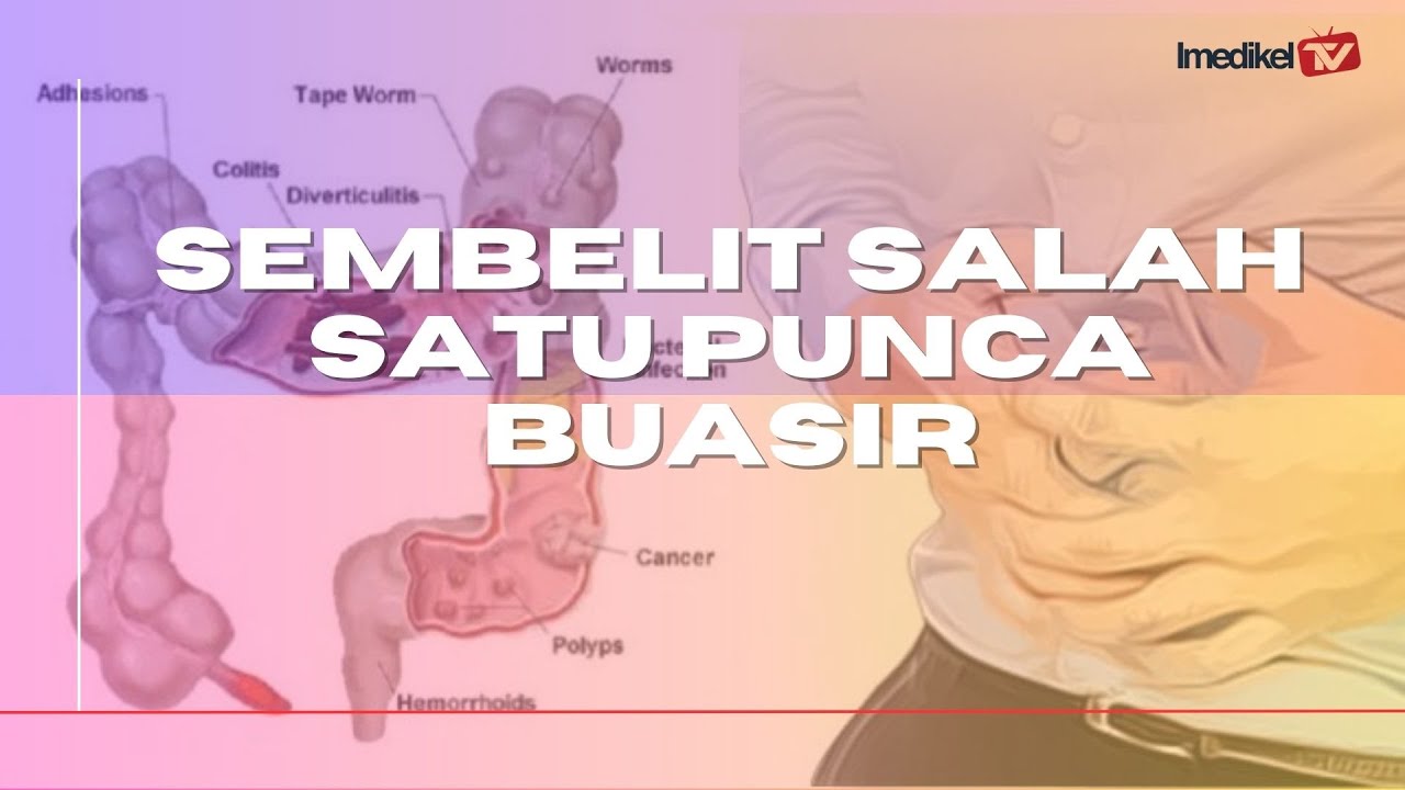 SEMBELIT SALAH SATU PUNCA BUASIR | Imedikel TV - YouTube