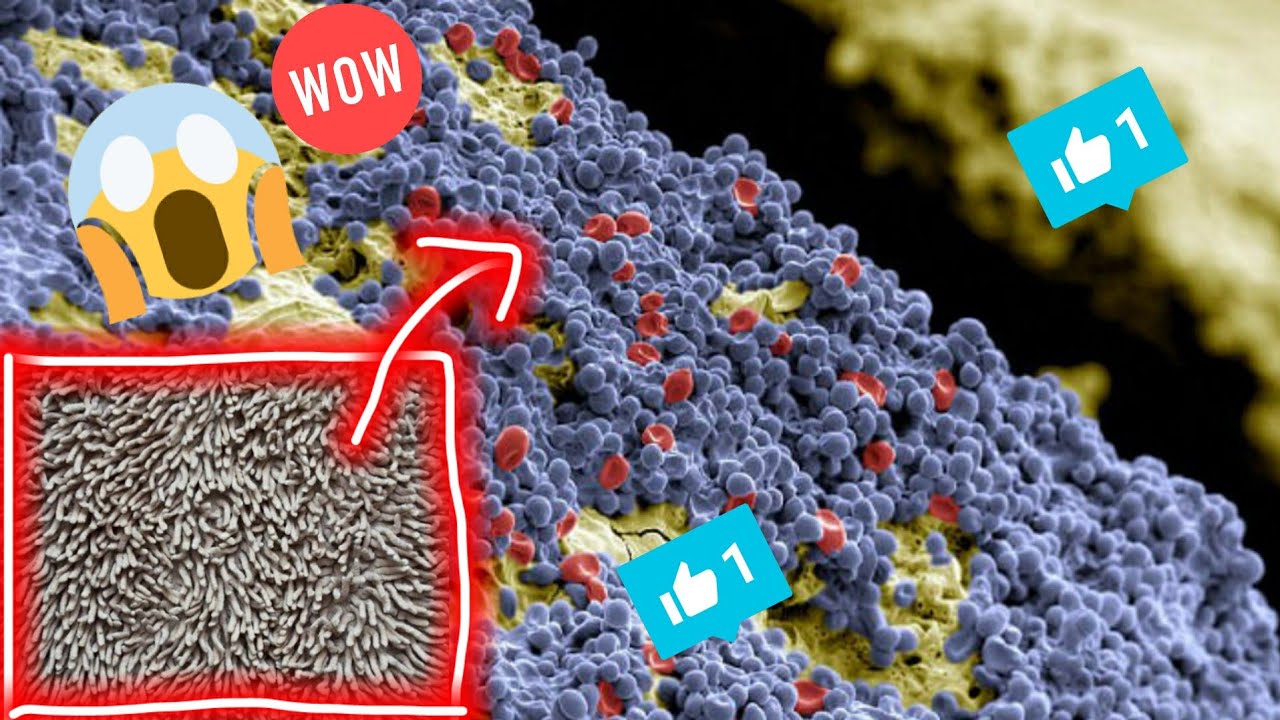 Carpet under a microscope! Wow! Watch until end. Life magnified - YouTube