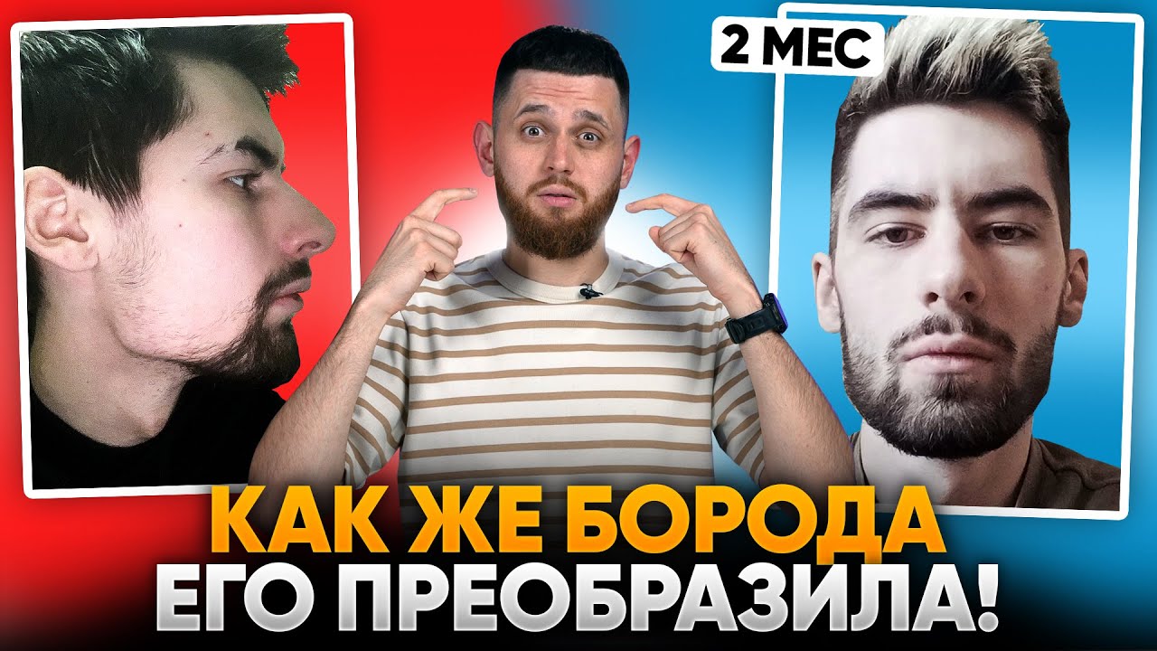 Совсем НЕ РОСЛА БОРОДА на щеках. Но он мазал MR.VOLOS и ПРЕОБРАЗИЛСЯ за 2 месяца! - YouTube