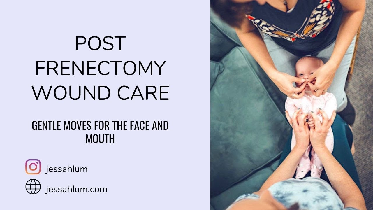 Post Frenectomy Wound Care | Gentle moves for the face and mouth # ...