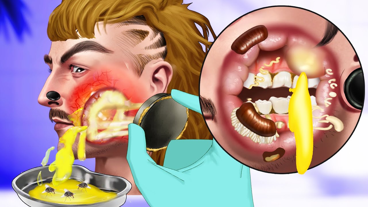 ASMR Cleaning big massive cheek hole gauge blowout on face infected ...