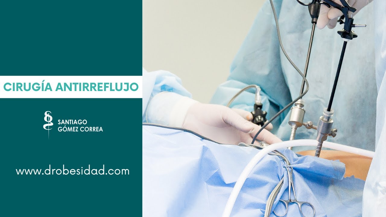 Cirugía Anti Reflujo: ¿Qué es y Cuándo Deberías Considerarla? - YouTube
