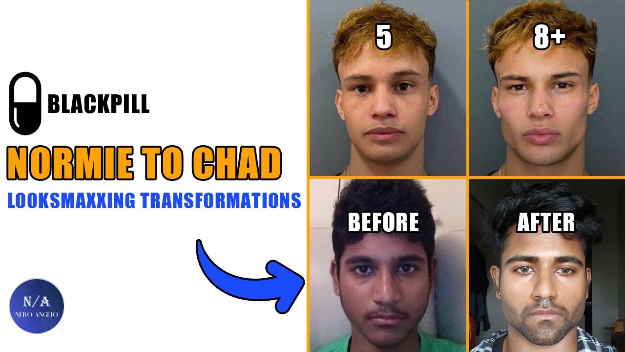 Amazing Normie To Chad Looksmaxxing Transformations (blackpill) - YouTube