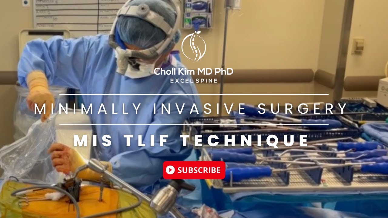 L3-4 & L4-5 MIS TLIF for Low Back Pain - YouTube