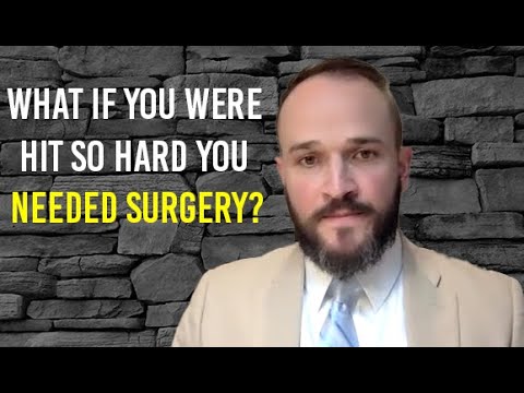 What If You Were Hit So Hard You Needed Surgery? - In Pain? Call Shane ...