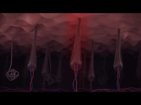 Diode Lazer Epilasyon