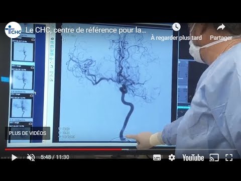 Le CHC, centre de référence pour la prise en charge de l’AVC (octobre ...