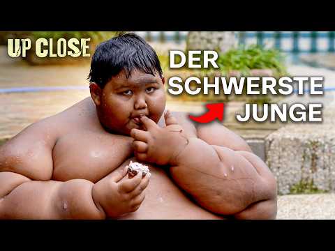 Die letzte Rettung für den schwersten Jungen der Welt
