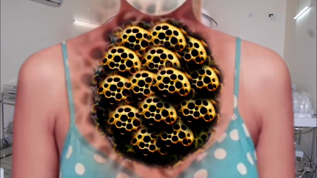 Asmr chest massage female barber infected hair removal|| ASMR infection ...