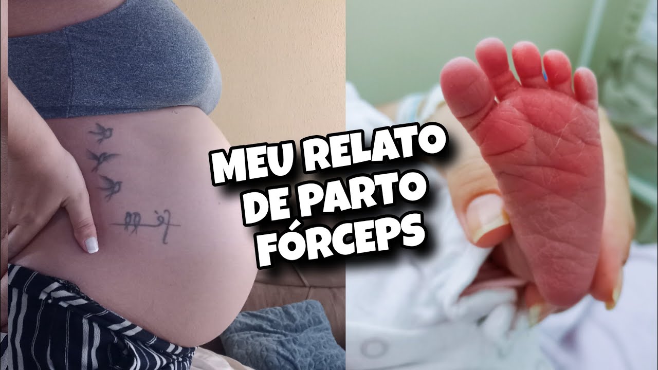MEU RELATO DE PARTO NORMAL COM FÓRCEPS - YouTube