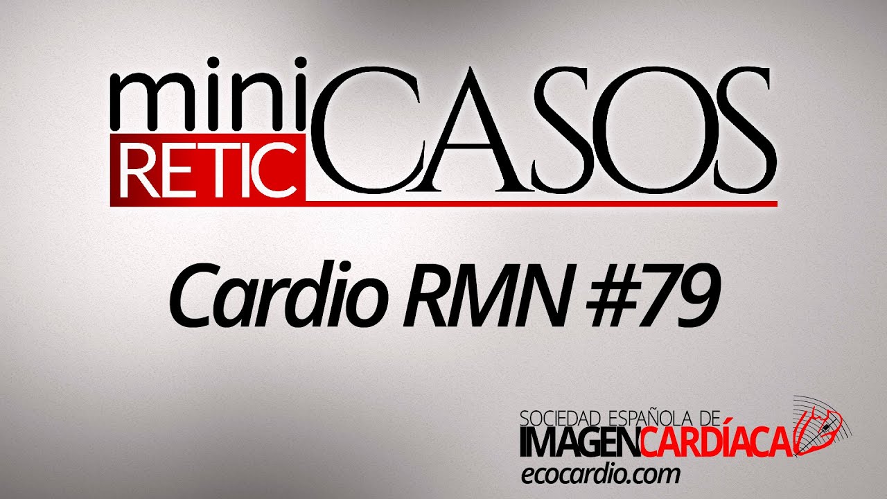 miniCASOS - Cardio RMN #79 - Respuesta - YouTube