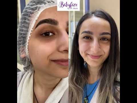 Dr. Nurlana Miabi prosedur