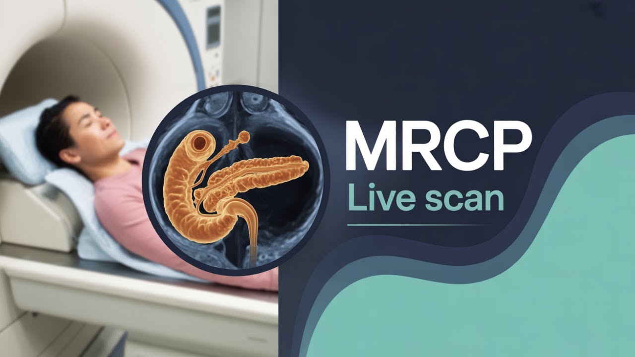 Real-Time MRI Workflow: Setting Up an MRCP Scan - YouTube