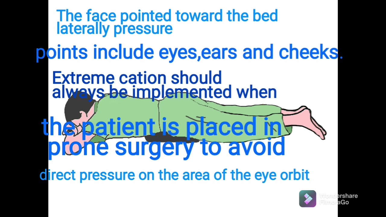 Lateral, sim's ,prone, trendelenburg and Dangling positions - YouTube