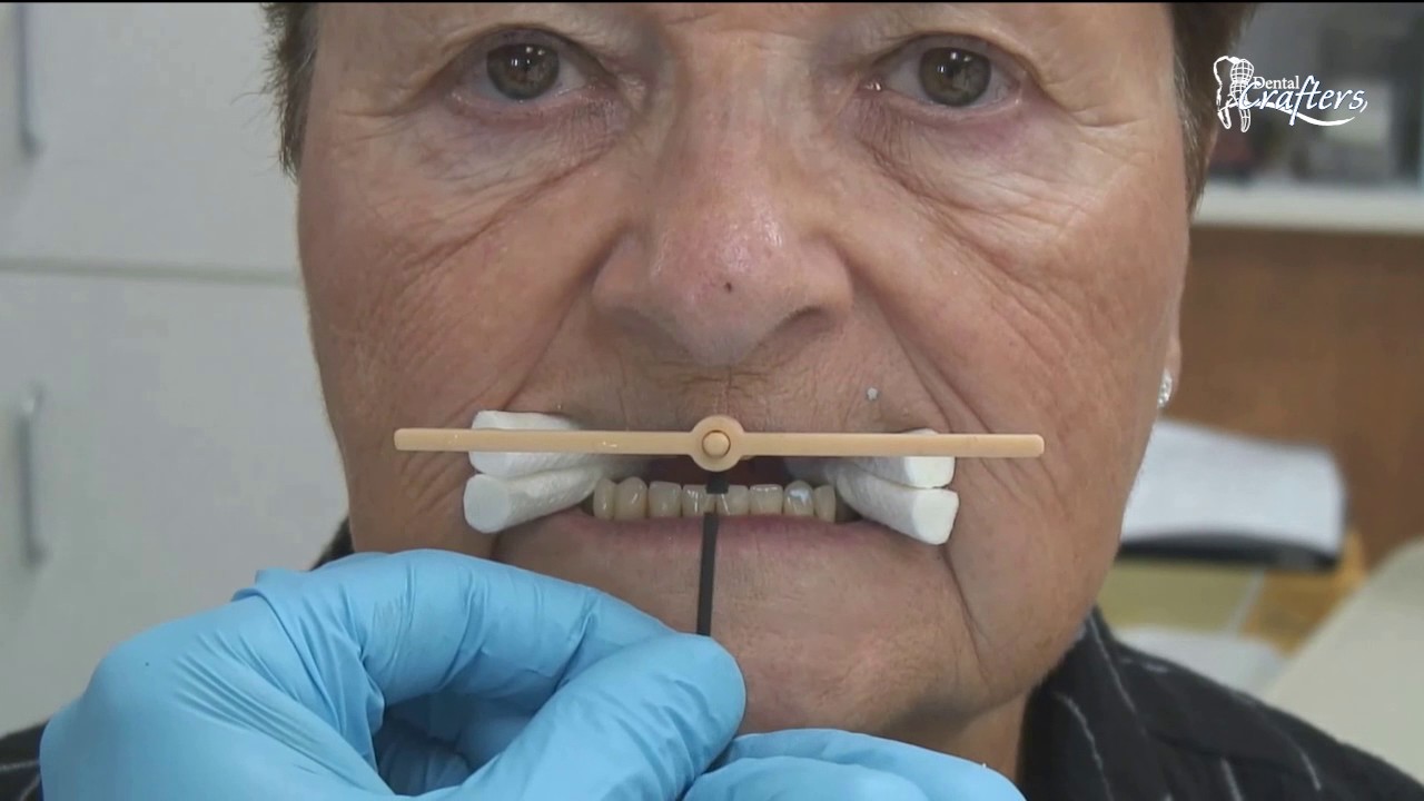 Occlusal Plane Analyzer - YouTube