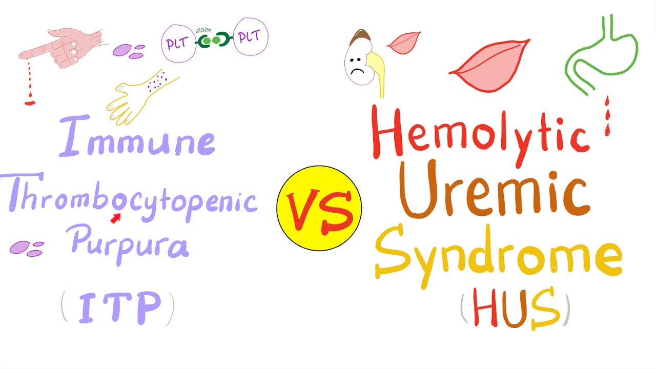 Immune Thrombocytopenia (ITP) vs Hemolytic Uremic Syndrome (HUS) - YouTube