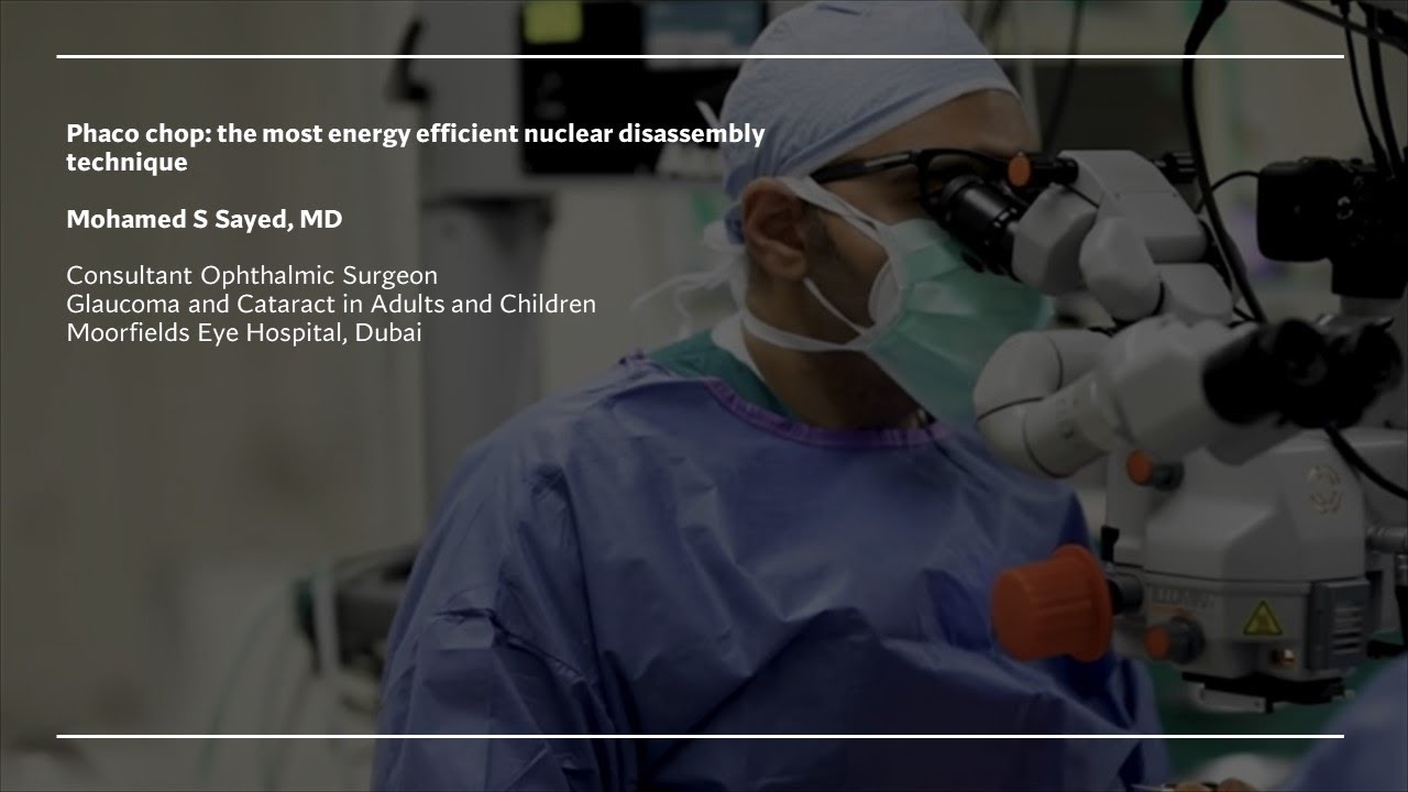 Phaco chop: the most energy efficient nuclear disassembly technique ...