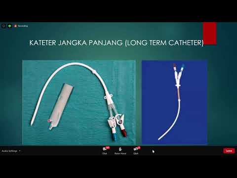 Management of Vascular Access for Hemodialysis (Session 1:Double Lumen ...