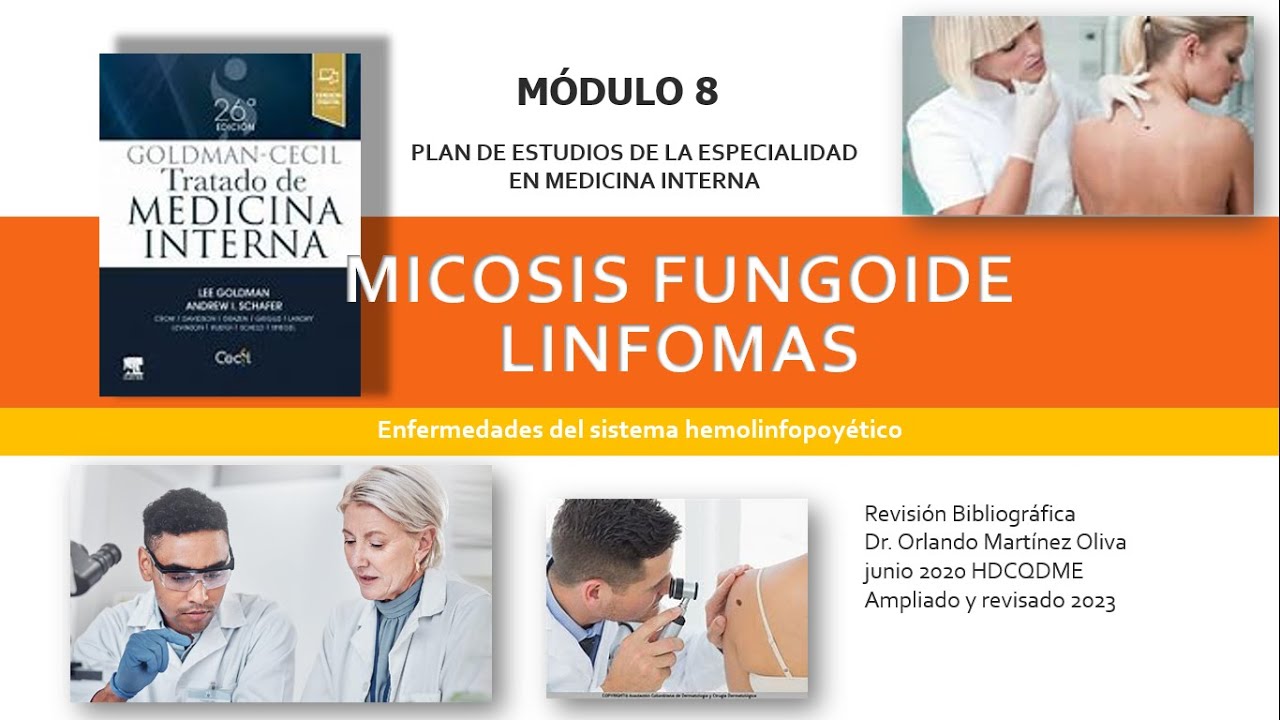 Micosis Fungoide/Síndrome de Sezary (MF/SS) - YouTube