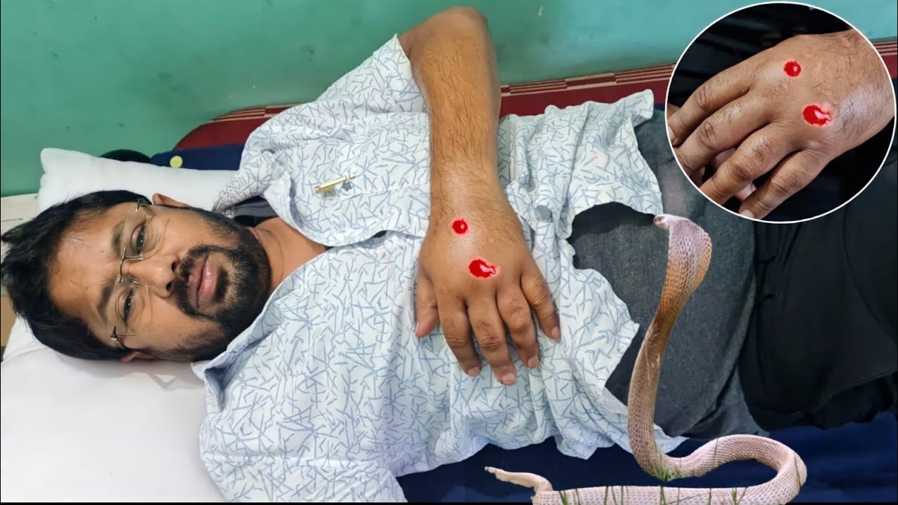 Cobra Snake Bite सर्पदंश के बाद Bapi da की हालत कैसा है Bapi da Snake ...