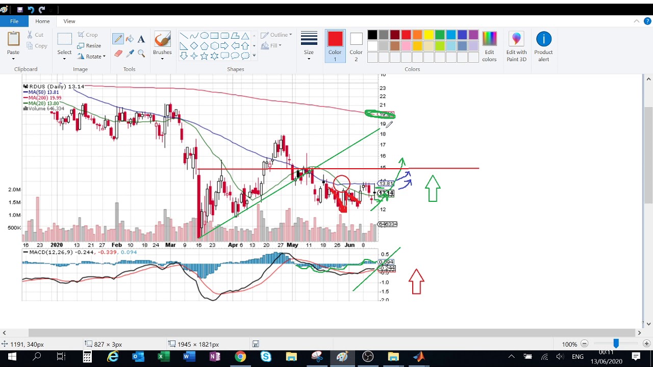 Stocks to Buy: RDUS Radius Health 2020 06 13 - YouTube