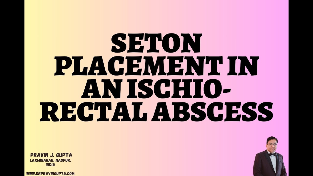 SETON PLACEMENT FOR ISCHIO-RECTAL ABSCESS - YouTube