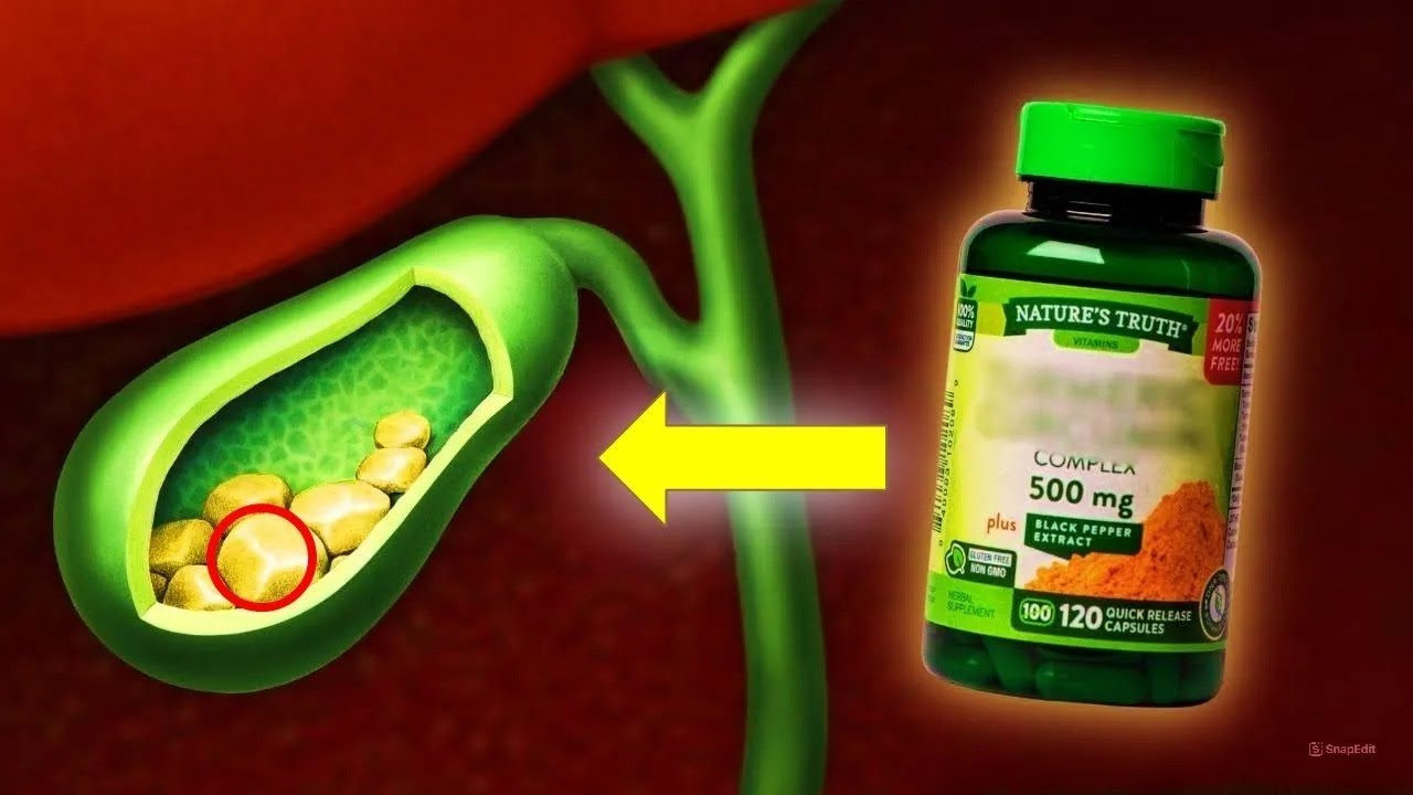 How to Flush Gallstones Naturally - YouTube