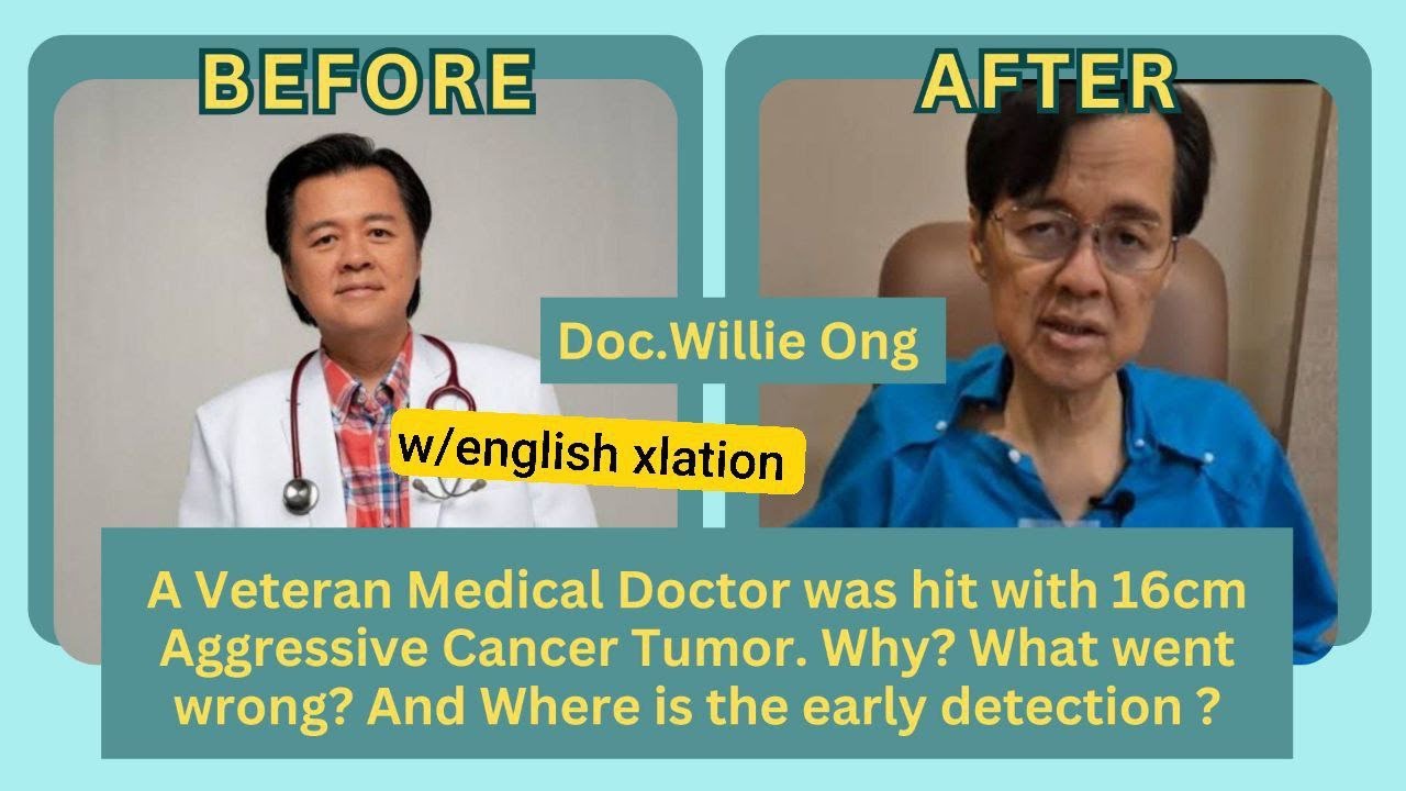 Doc Willy Ong MD, a good veteran doctor hit by aggressive cancer. What ...