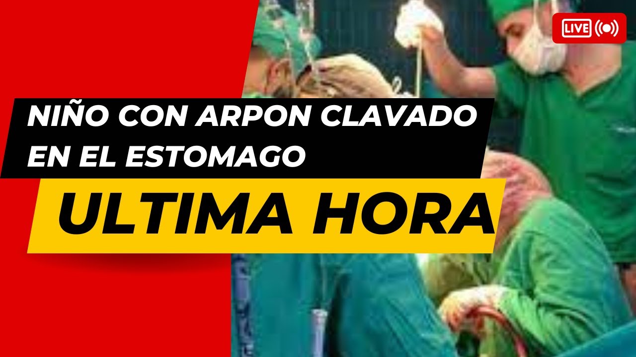 NIÑO CON ARPON CLAVADO EN EL ESTOMAGO/ Ultimas Noticias de Cuba Hoy 5 ...