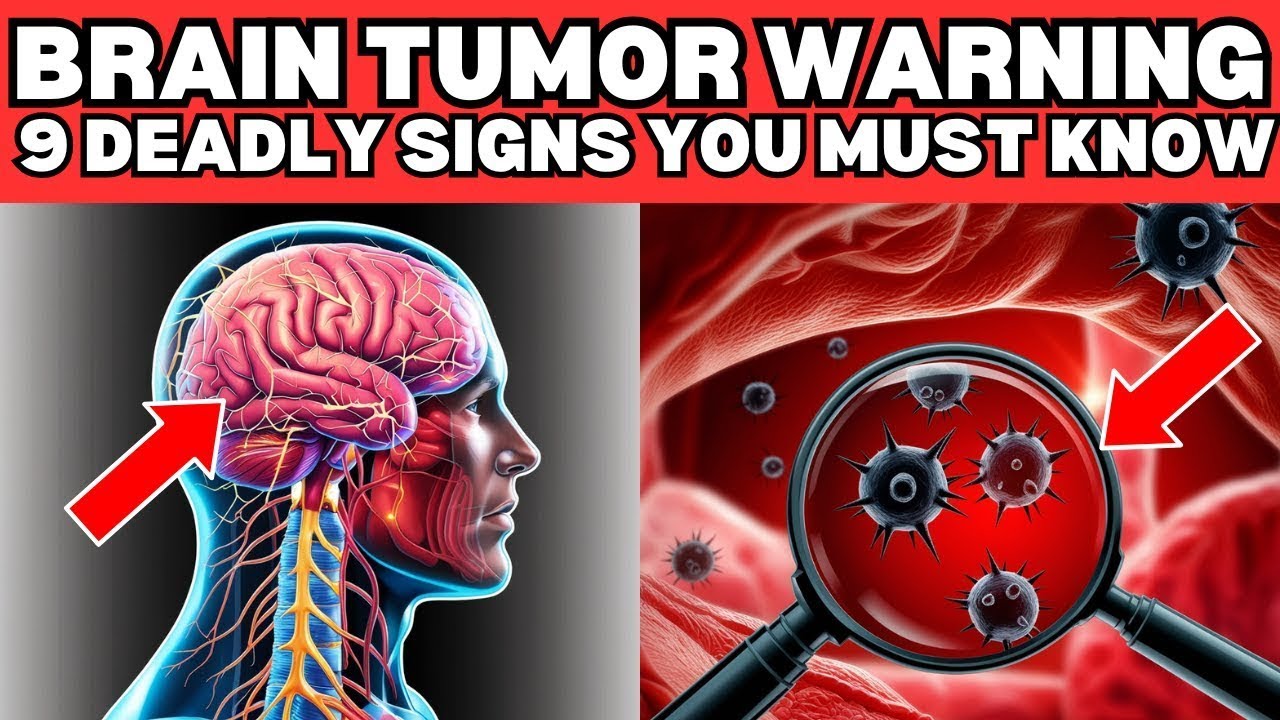 Did You Know The 9 WARNING SIGNS OF A BRAIN TUMOR – DON’T IGNORE THESE ...