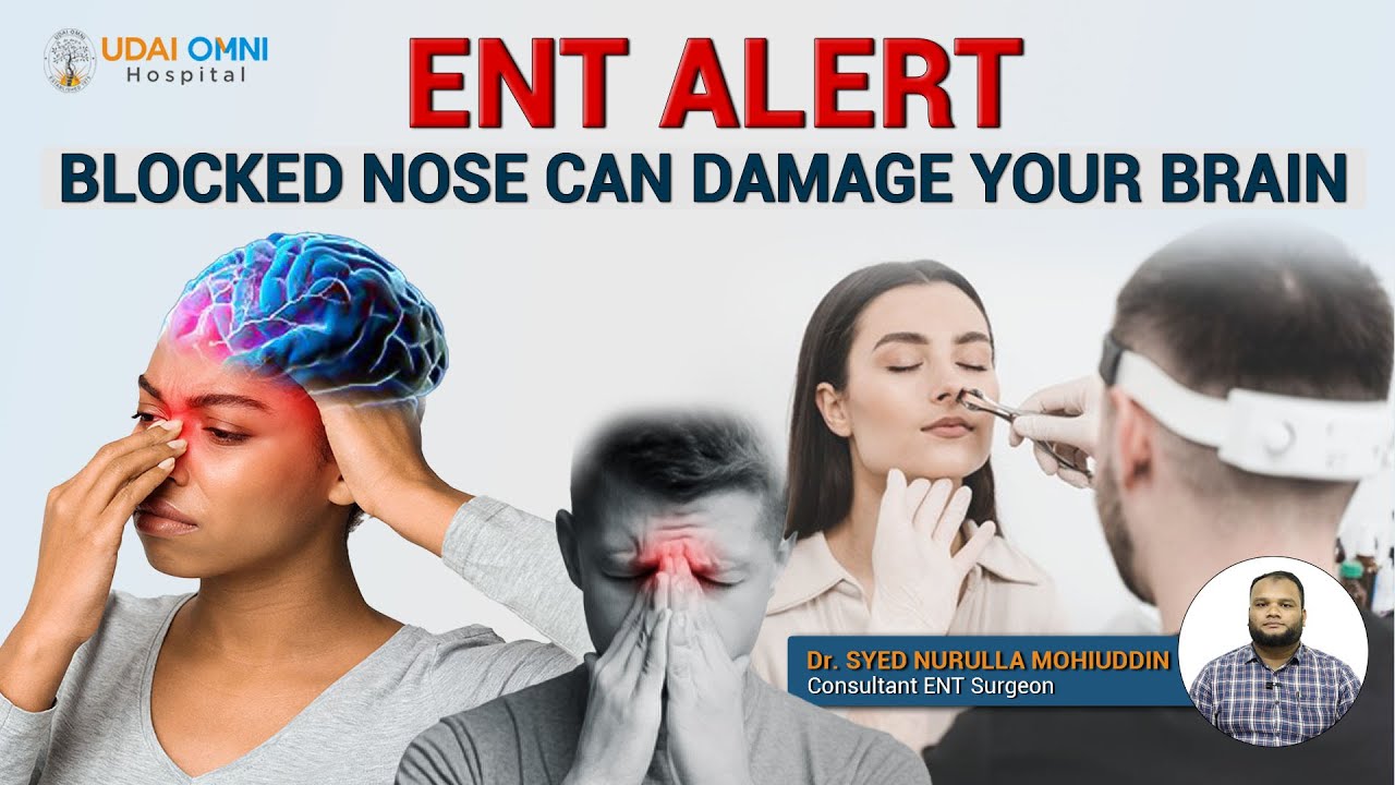 Thinking It’s Just a Cold? Blocked Nose May Risk Brain Health | ENT ...