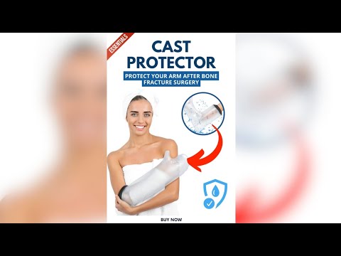 Protect Your Arm After Bone Fracture Surgery with Cast Protector ...