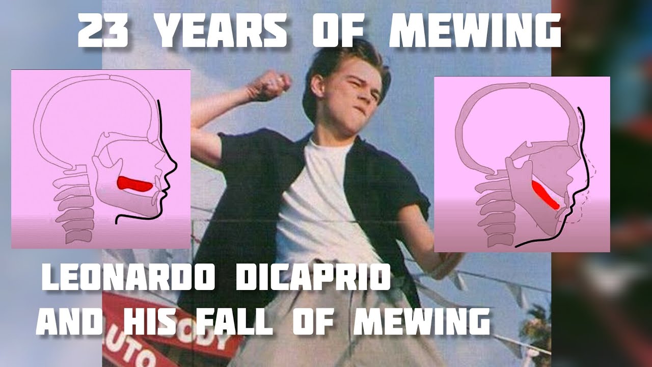 Leo's mistakes on mewing, No longer the hollywood charm ? - YouTube