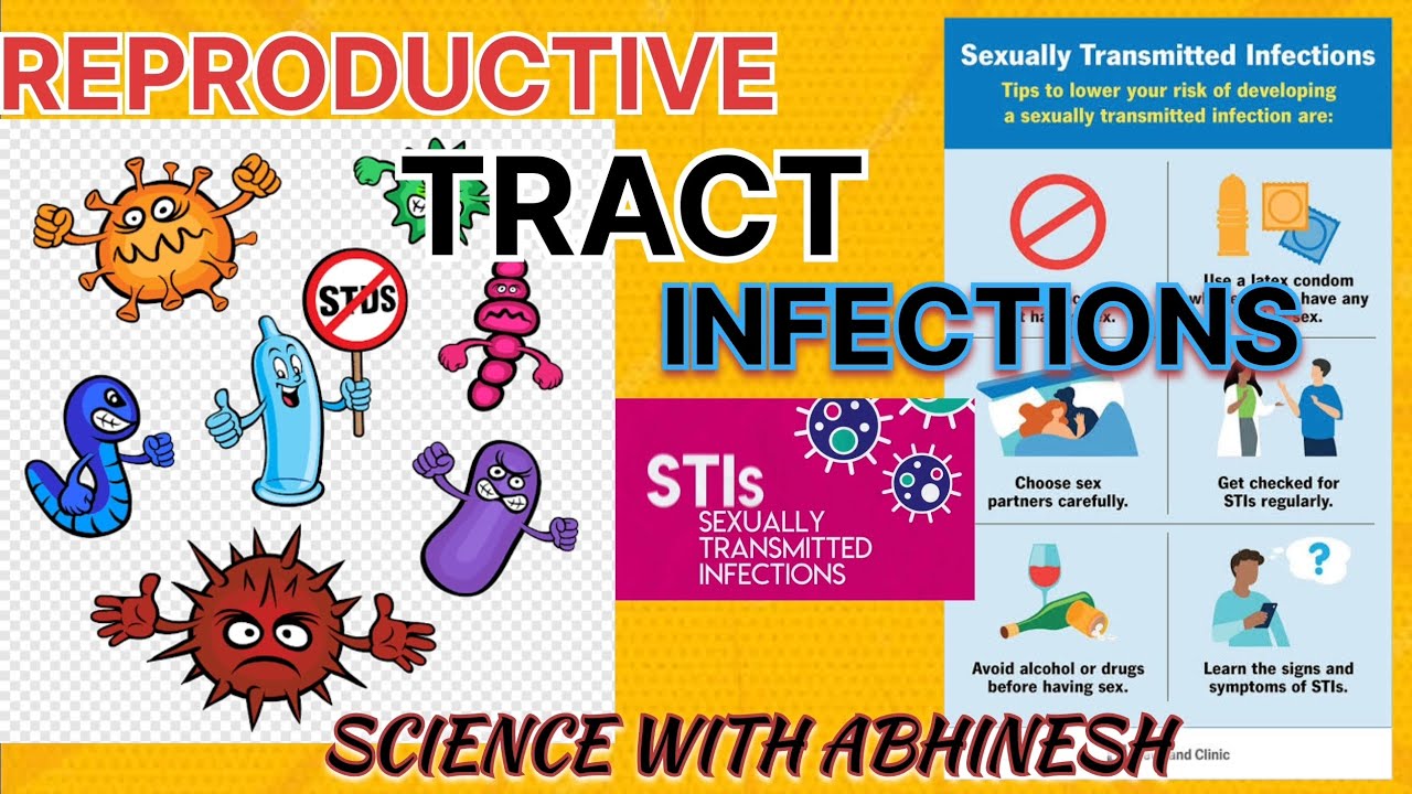 REPRODUCTIVE TRACT INFECTIONS #Sexuallytransmitteddiseases # ...